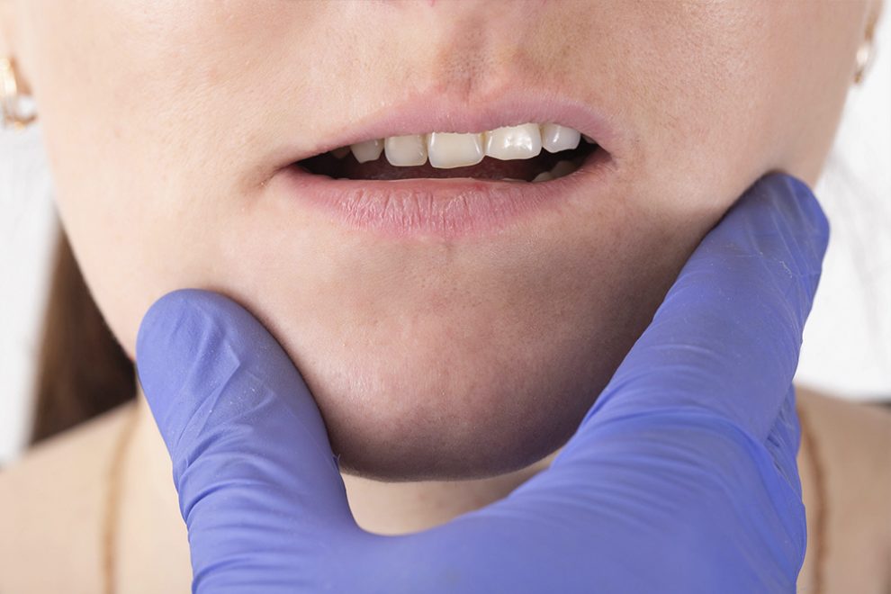 Tipos de mordidas y problemas de oclusión| Drs. Moreno-Montalvo